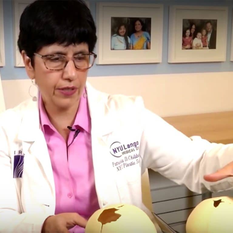 What are Craniofacial Differences? | myFace